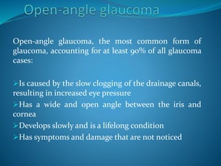 Genetics of glaucoma | PPTX