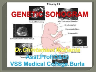 Genetic sonogram | PPTX