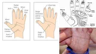 Genetics Practical 5.pptx