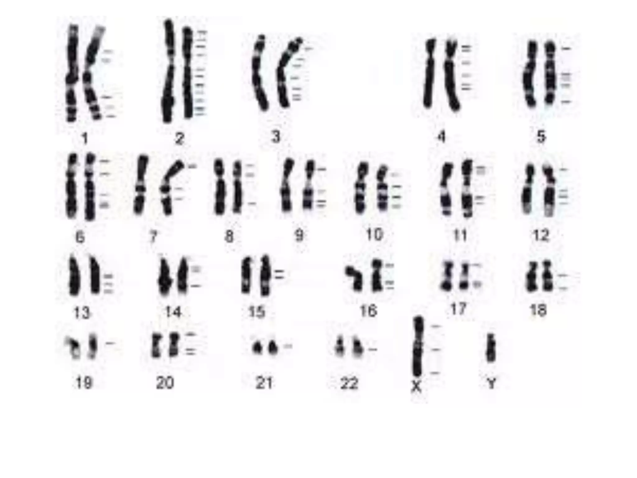 Chromosomal Disorders | PPTX