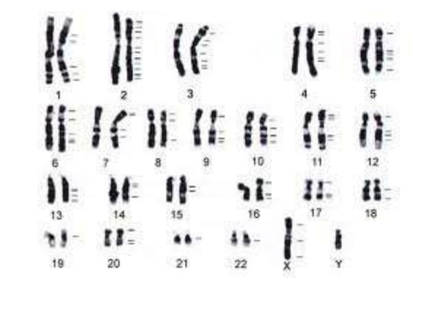 Chromosomal Disorders | PPT