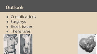 Vacterl Syndrome | PPTX