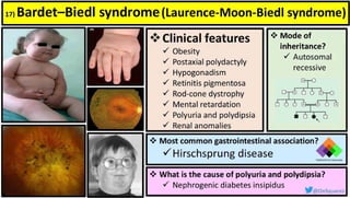 Genetic syndromes | PDF