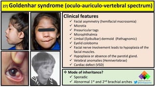 Genetic syndromes | PDF