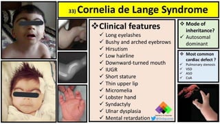 Genetic syndromes | PDF