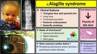 Genetic syndromes | PDF