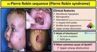 Genetic syndromes | PPT