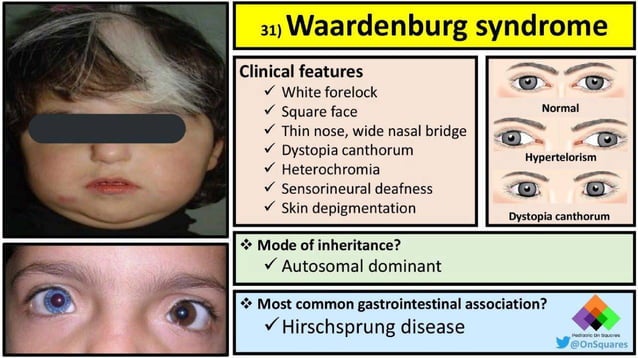 Genetic syndromes | PPT