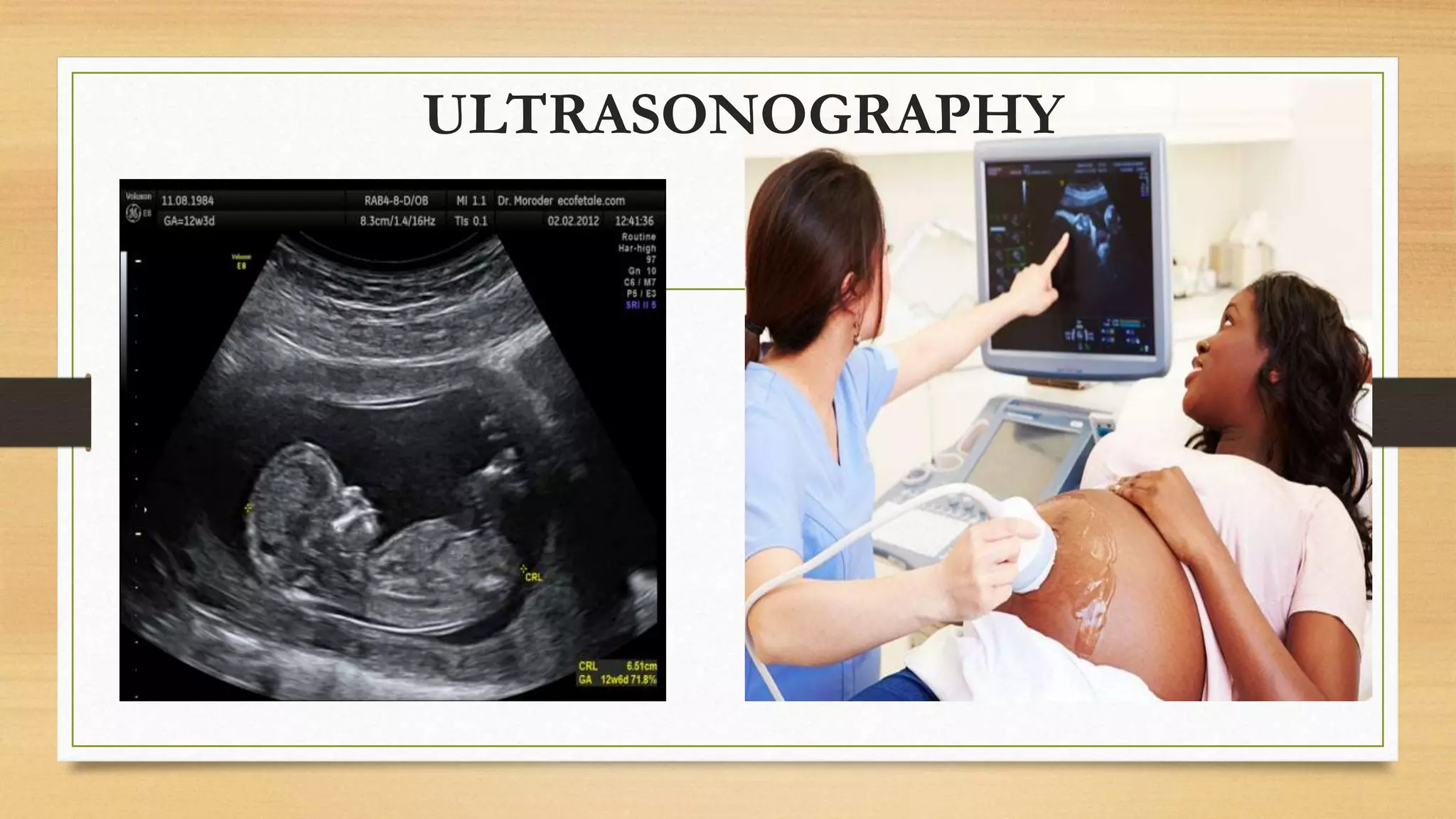 Genetic testing in the neonates and children.pptx