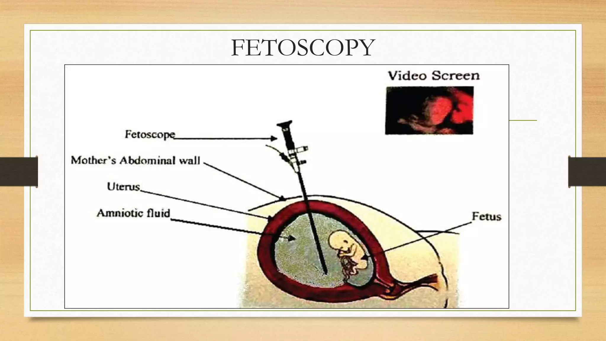 Genetic testing in the neonates and children.pptx