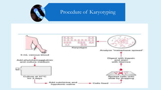 Genetic tests overview - Karyotype, FISH, MLPA, CMA, Sanger sequencing ...