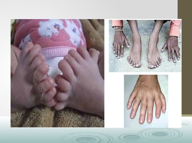 PEWARISAN GENETIKA (HEREDITAS) PADA MANUSIA.pptx