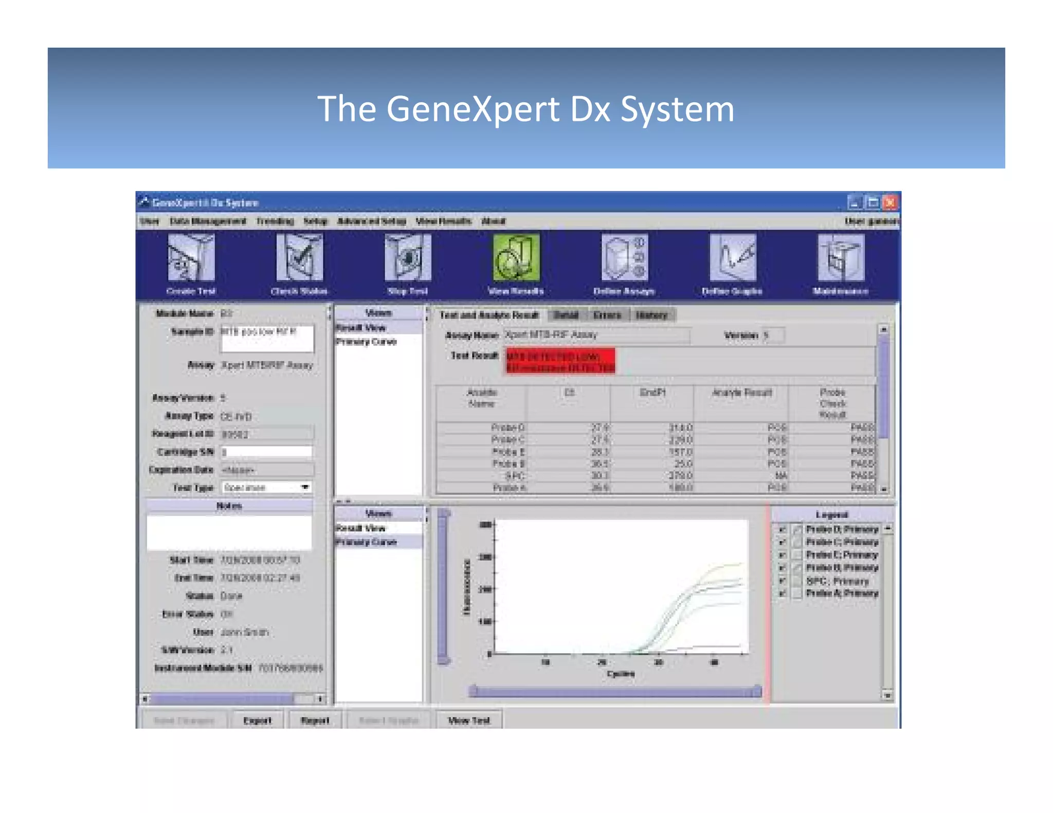 Gene Xpert | PDF