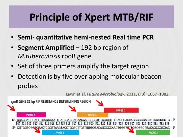 Gene Xpert & Advances