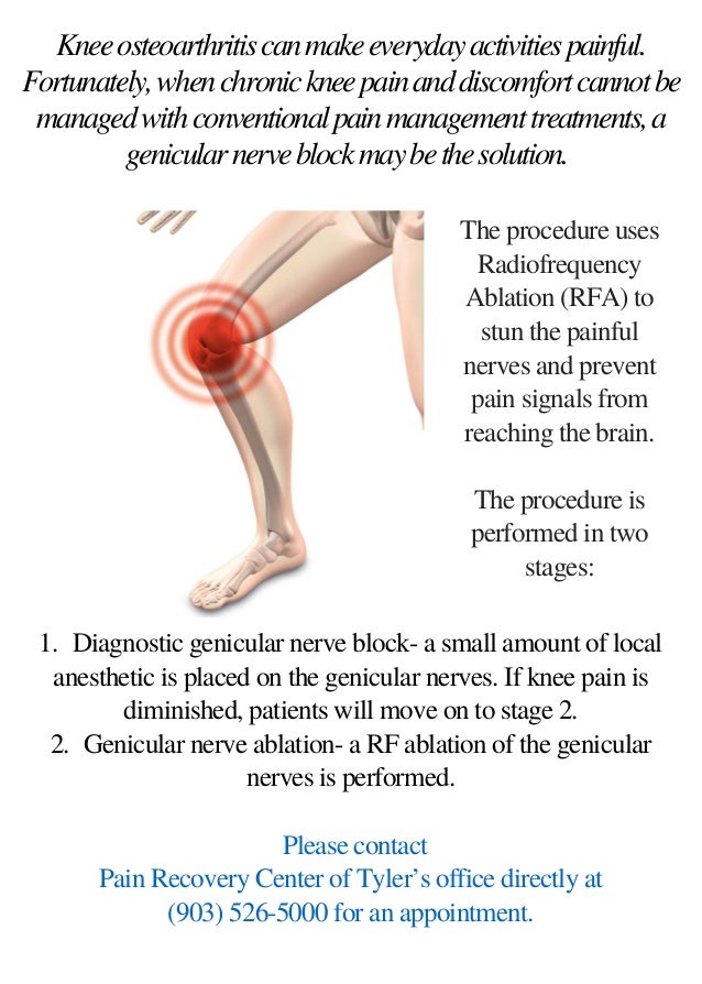 Knee Pain | Knee Osteoarthritis | Genicular Nerve Block Knee Pain | Knee Osteoarthritis | Genicular Nerve Block