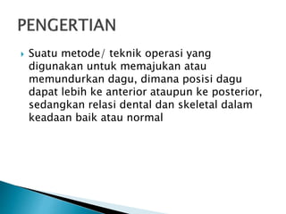 Genioplasty | PPTX