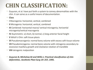 Genioplasty | PPT