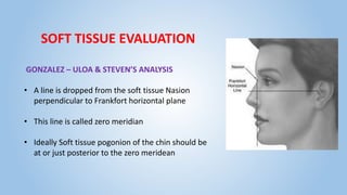 Genioplasty | PPTX