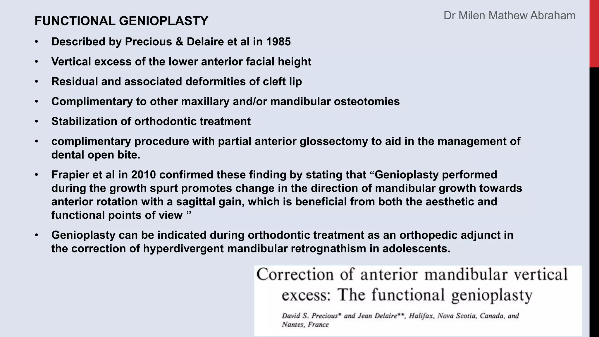 Genioplasty (1) | PPTX