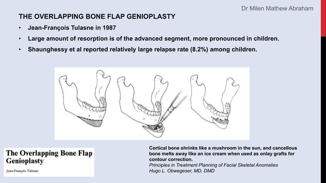 Genioplasty (1) | PPTX