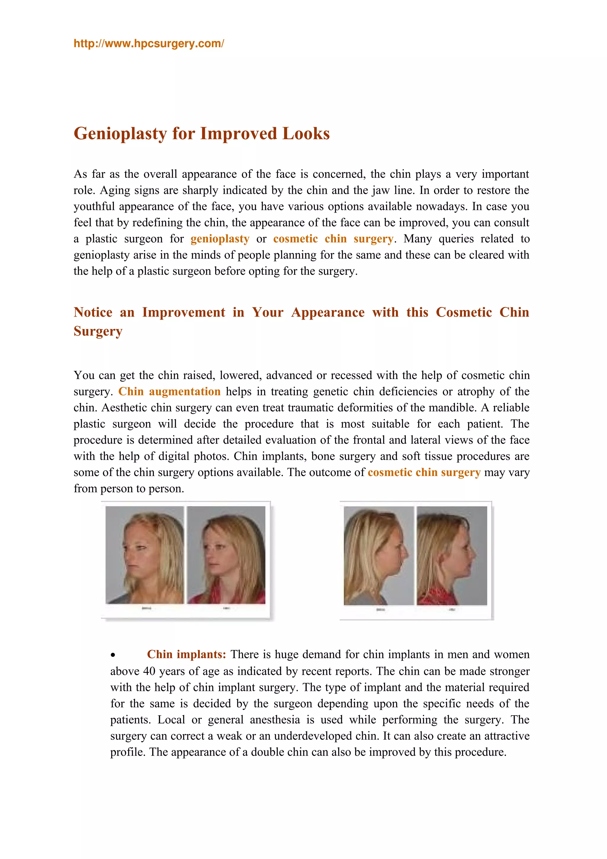Genioplasty for improved looks | PDF