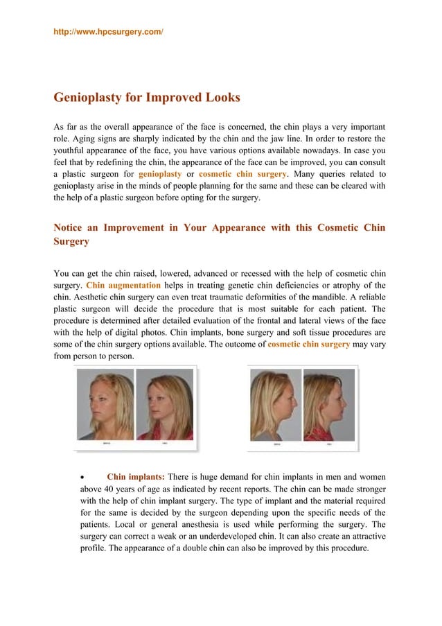 Genioplasty for improved looks | PDF