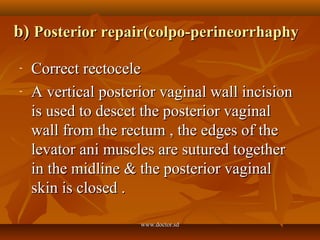 Genital Prolapse | PPT