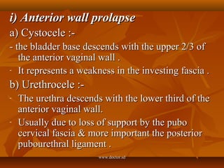 Genital Prolapse | PPT