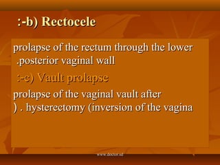 Genital Prolapse | PPT