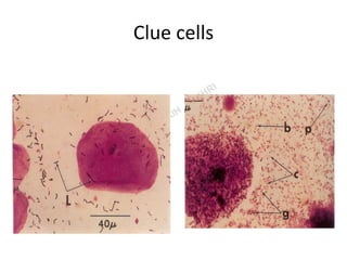Approach to Genital discharge | PPT