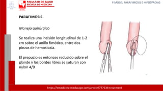 Fimosis y Parafimosis | PPTX