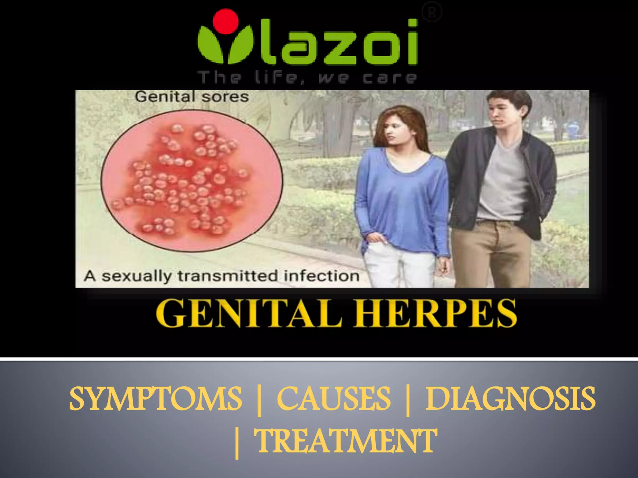 Genital herpes : Symptoms, causes diagnosis and treatment | PPTX