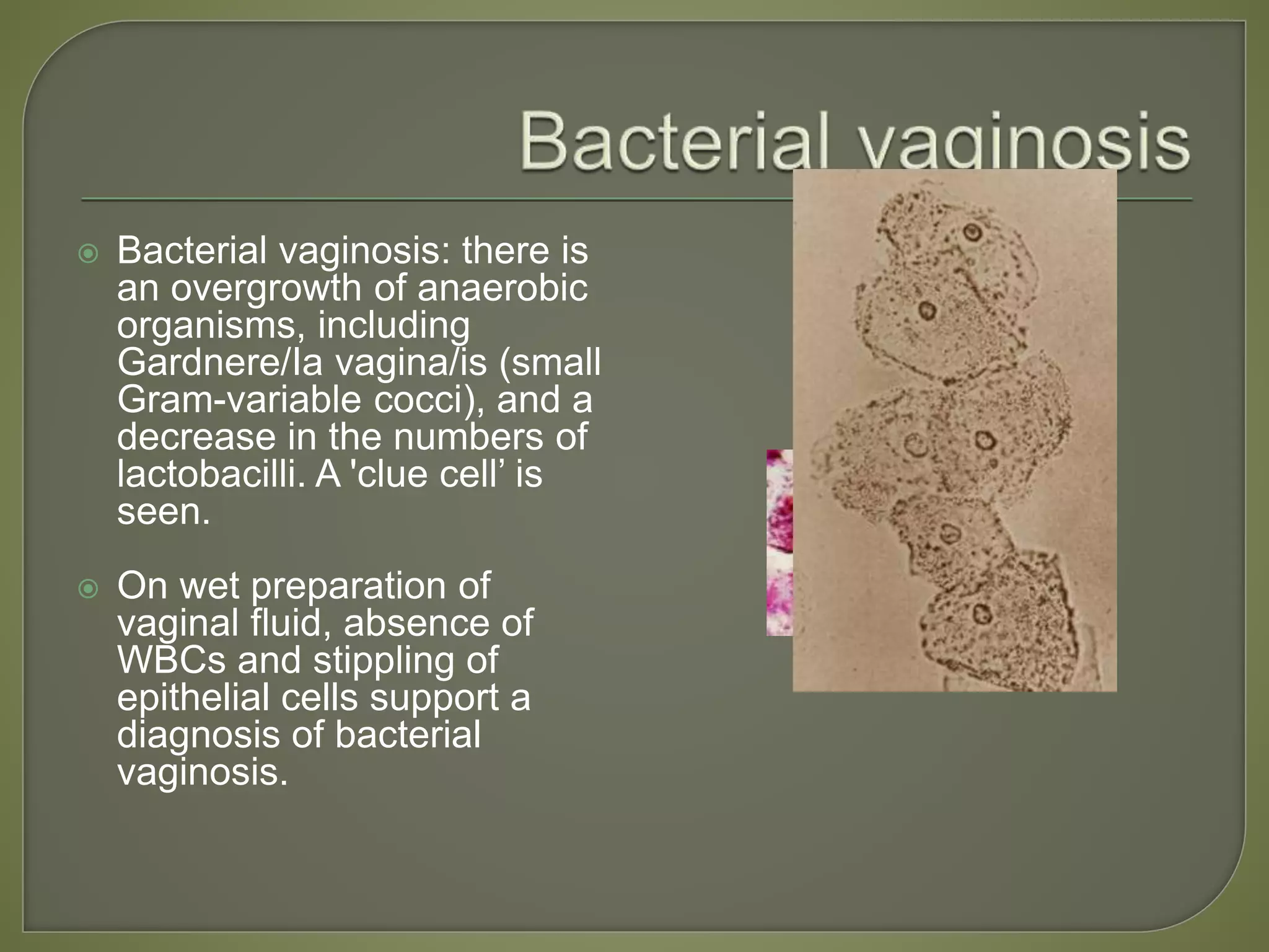 Genital infections in gynecology | PPTX