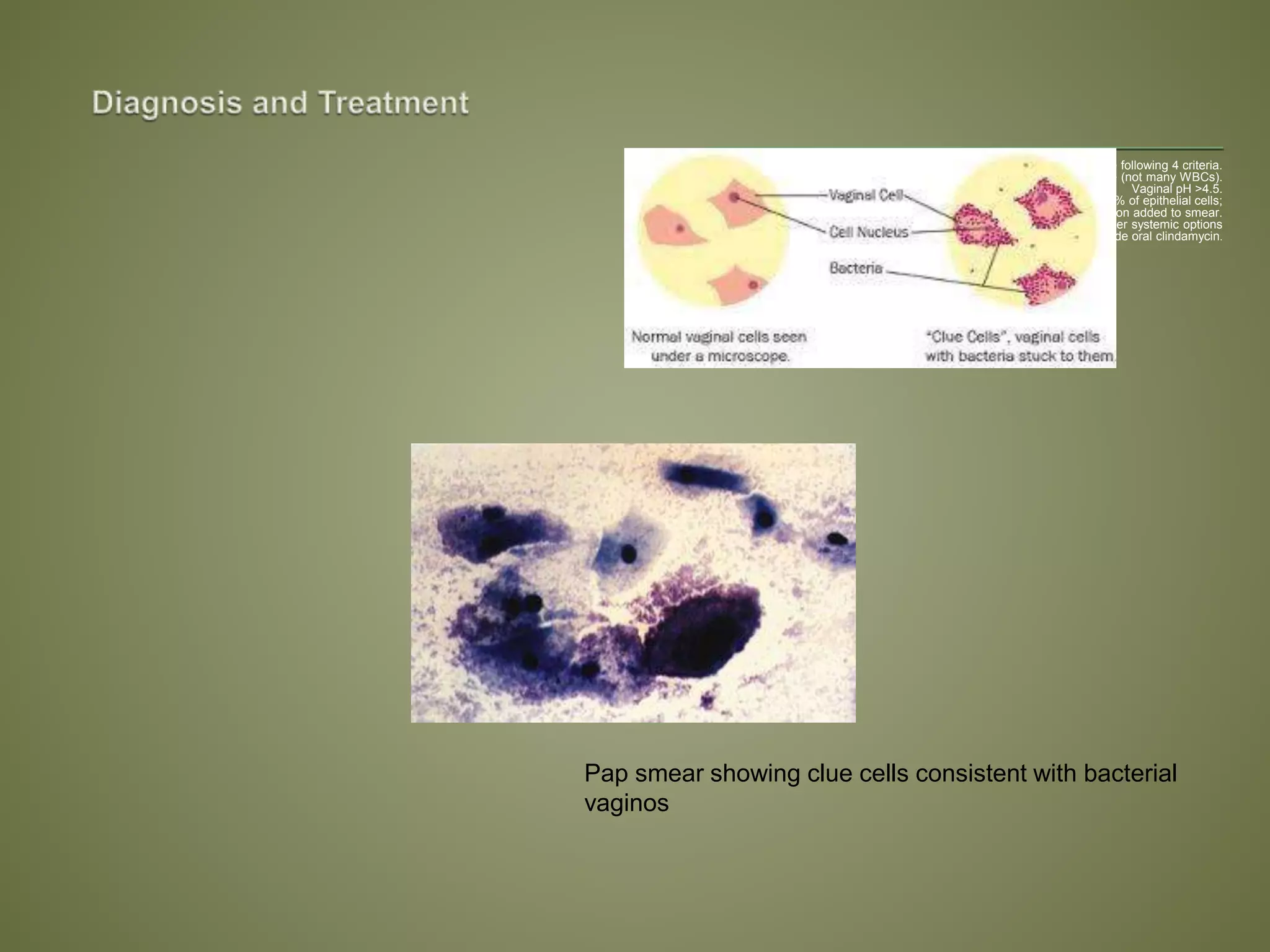 Genital infections in gynecology | PPTX