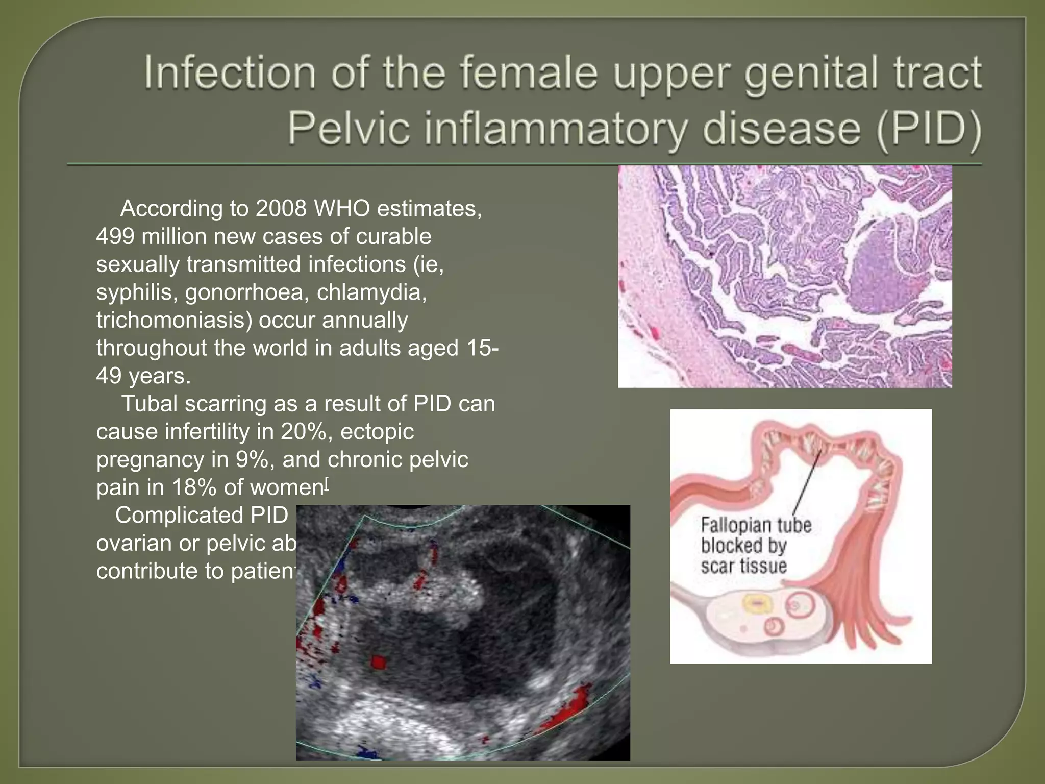 Genital infections in gynecology | PPTX