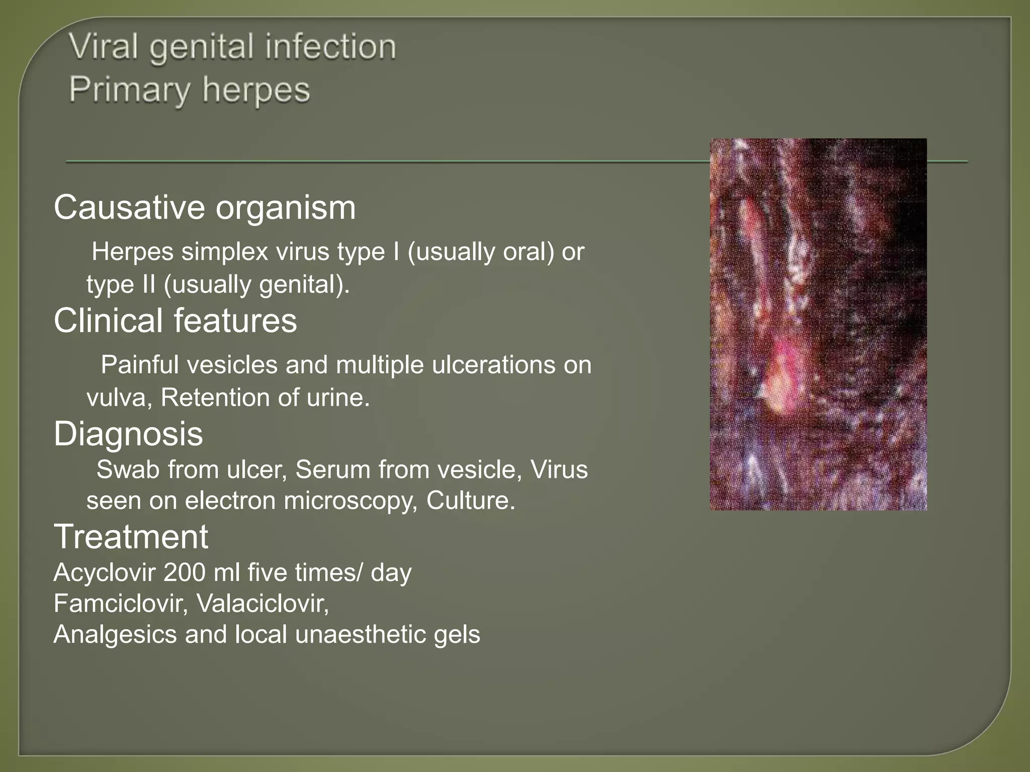 Genital infections in gynecology | PPTX