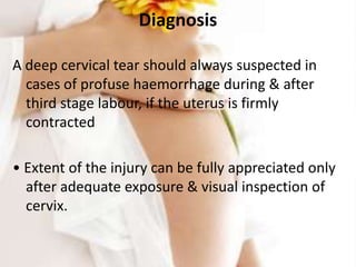 Genital injuries obs nursing | PPTX