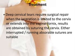 Genital injuries obs nursing | PPTX