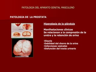 GENITAL MASCULINO UNSF SUCRE BOLIVIA.pdf