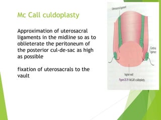 genital prolapse 3-8-23.ppt