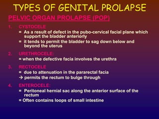 GenitalProlapse AUDIO.ppt