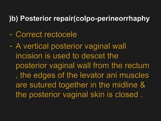 Genital prolapse by daniel rawand | PPT