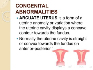 Genital reproductive system (grs) | PPTX