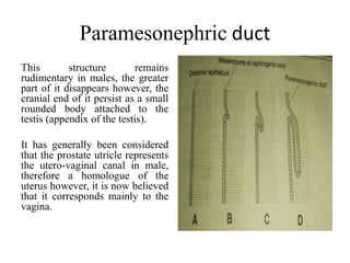 Genital system 2206.pptx