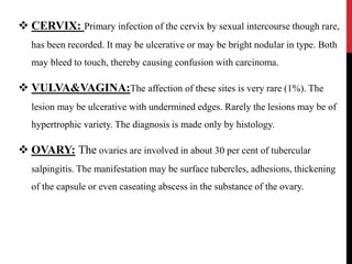 Seminar on genital Tuberculosis | PPTX