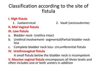 Genital tract fistulas main | PPTX