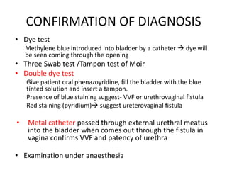 Genital tract fistulas main | PPTX