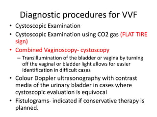Genital tract fistulas main | PPTX