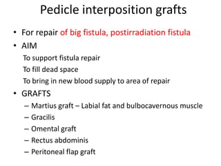 Genital tract fistulas main | PPTX