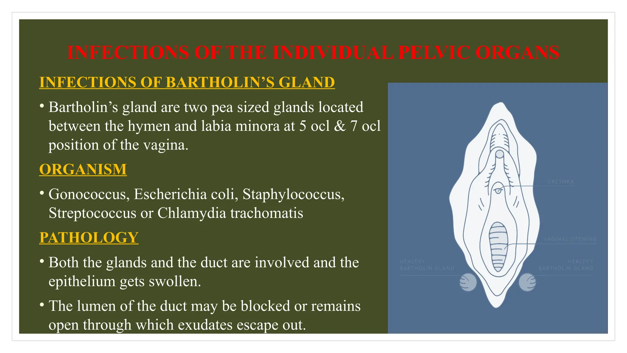 GENITAL TRACT INFECTIONS obstetrics and gynaecological nursing | PPTX